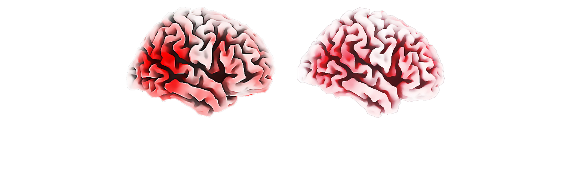Concussion Recovery Therapy - Concussion Recovery Therapy